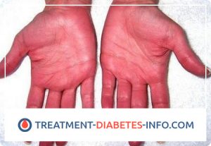 Erythremia – Healthy Lifestyle Blog